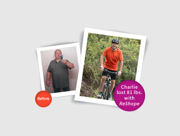 ReShape Success Story Winner: Charlie | ReShape Gastric Balloon